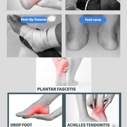 Foot Splint For Heel Pain Treatment For Plantar Fasciitis, Achilles ...